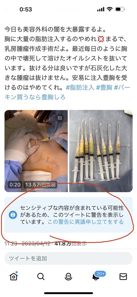 麻生 泰 On Twitter 通報されたようですので投稿が消える可能性があるのでもう一度投稿しておきます。脂肪注入による豊胸手術でできた