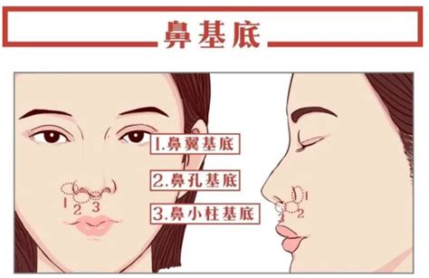 鼻唇沟填充术多少钱 有来医生