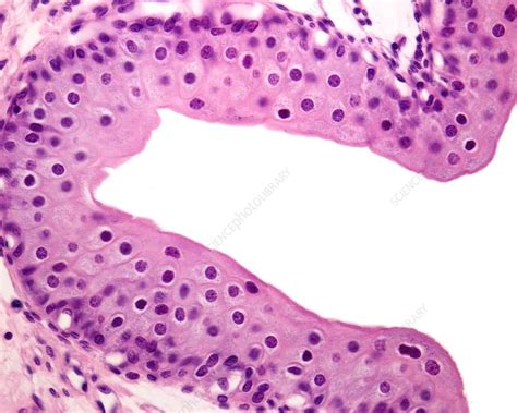 Transitional Epithelium Under Microscope
