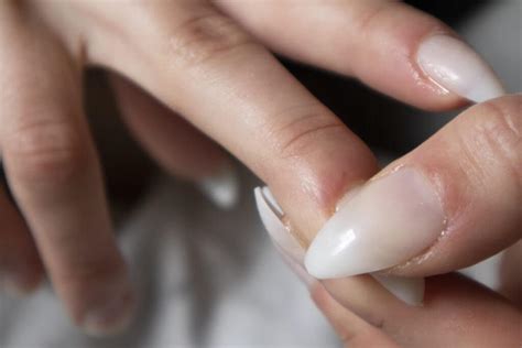 How To Remove Glue On Nails Easy Steps With Pictures