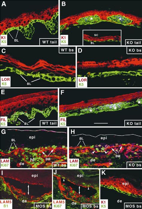 Figure 3 From Conditional Ablation Of Beta1 Integrin In Skin Severe