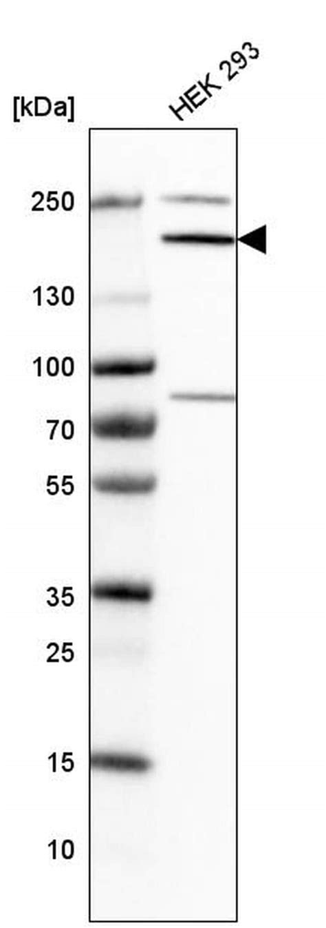 Synaptojanin 1 Antibody Pa5 82442