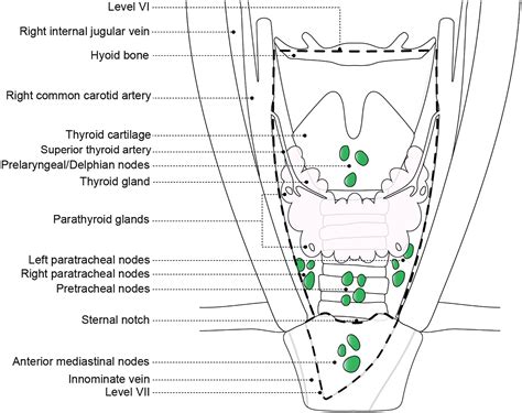 A Nod To The Nodes Surgical Oncology Clinics