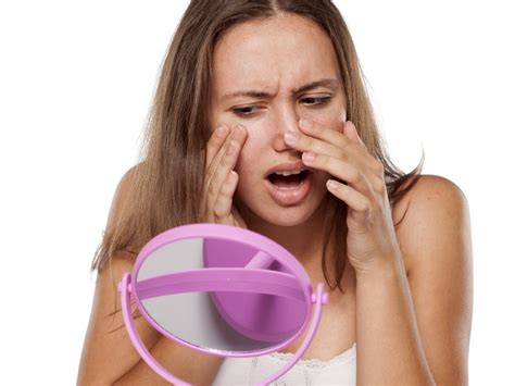 Natural Tips To Cure Pimples Completely From Face