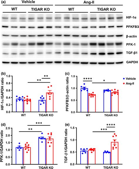 Tigar Deficiency Increases Glycolytic Enzyme And Pro‐fibrotic Factor In