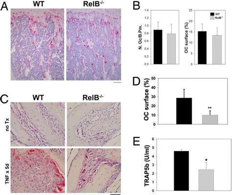 Relb Is Important For Tnf Stimulated Bone Resorption In Vivo A Trap