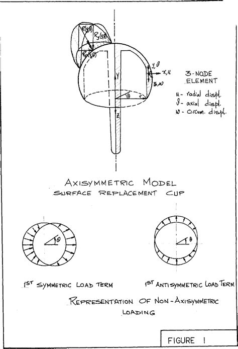 Figure 1 From Finite Element Analysis Of The Femoral Head Semantic