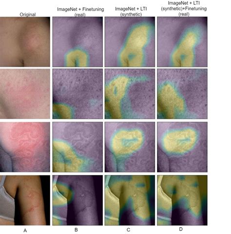 Comparison Of The Class Activation Maps For Different Protocols On