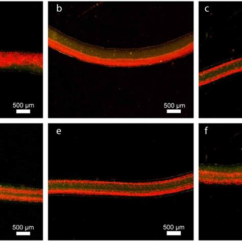 The Polystyrene Microparticle Red In The Mixture Of The Sodium Download Scientific Diagram