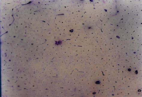 Help With Analyze Particles Error Counting Entire Speckle Rimagej