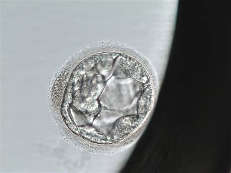 Hatched Human Blastocyst Grade Bb On The Fifth Day Of Development Viewed Under The Microscope