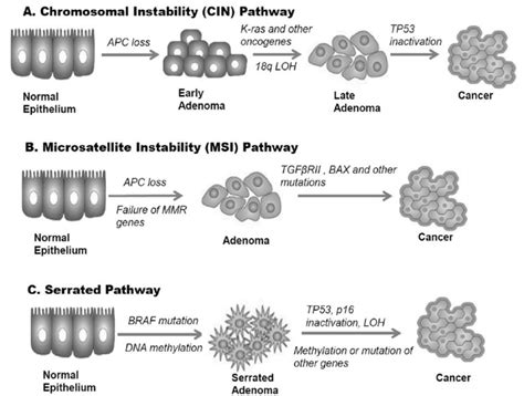 Multiple Genetic Pathways In Crc Carcinogenesis A Chromosomal Download Scientific Diagram