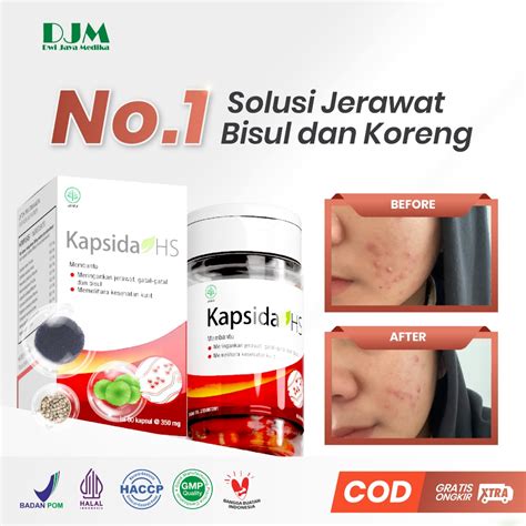 Jual Kapsida Hs 60 Kapsul Botol Obat Jerawat Gatal Alergi Bisul