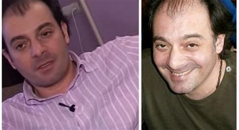 ქიმიოთერაპია ექვსჯერ გავიკეთე ახლა კიდევ მივდივარ ღმერთის წყალობით კარგად ვარ რას