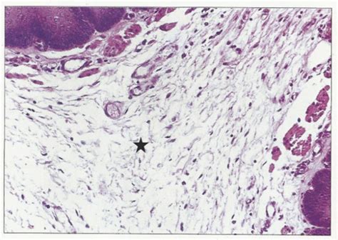 Histo Lab Connective Tissue Proper Flashcards Quizlet