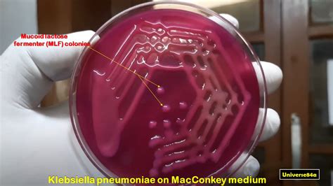 Macconkey Agar Enterobacter Aerogenes