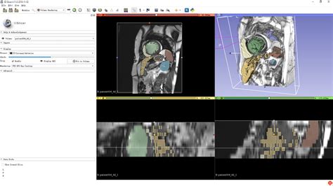 Nifti Data Segmentation Result For Cardiac Mri Data Download Scientific Diagram