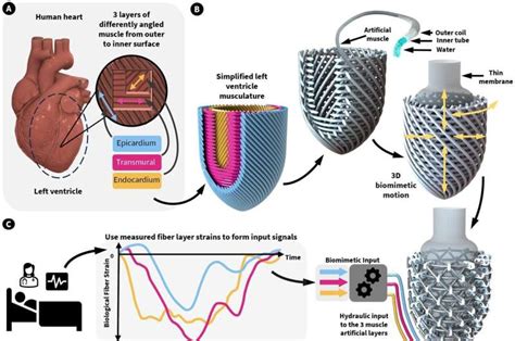 Artificial Left Ventricle Mimics The Shape And Function Of The Human Heart Healthmedicinet