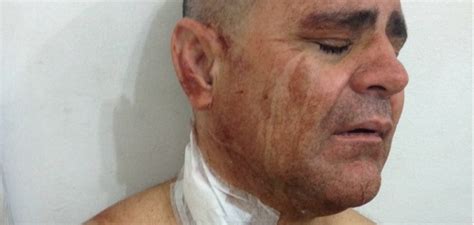 Por Amor Homem Mata Ex Mulher A Facadas E Tenta Suicídio Notícias