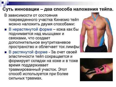 Тейпирование живота: как это работает, виды и схемы, как выбрать тейпы
