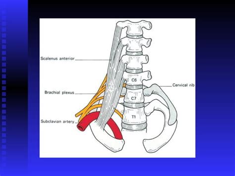 Brachial Plexus Origin Structure And Supply Ppt
