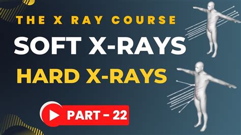 Soft And Hard X Rays Part 22 The X Ray Course Doctor Inside Academy Youtube