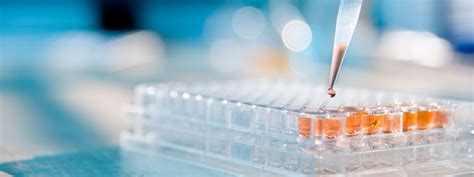 Span Diagnostics Sarl