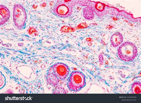 Scalp Hair Follicles Human Under Microscope Stock Photo Shutterstock