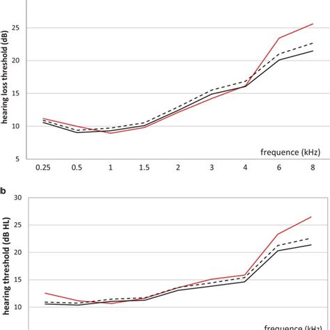 A Difference In Hearing Threshold Db Of The Right Ear B Difference Download Scientific