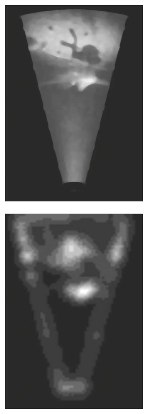 Comparison Results Using Different Preprocessing Methods For Improving