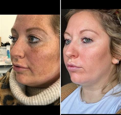 Obagi Medical Grade Skincare Bishops Waltham And Otterbourne Uk