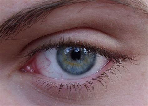 Dilated Fundus Examination Alchetron The Free Social Encyclopedia