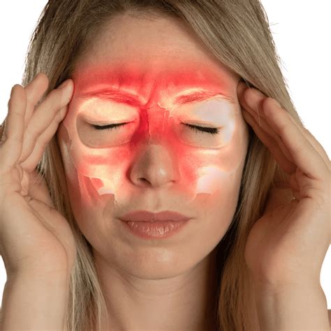 Acupuncture For Sinus Headaches A Proven Treatment