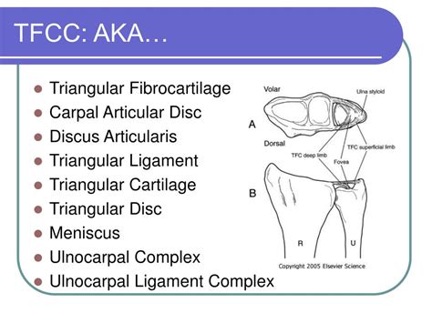 Ppt Triangular Fibrocartilage Complex Powerpoint Presentation Free Download Id4193721 Ppt Triangular Fibrocartilage Complex Powerpoint Presentation Free Download Id4193721