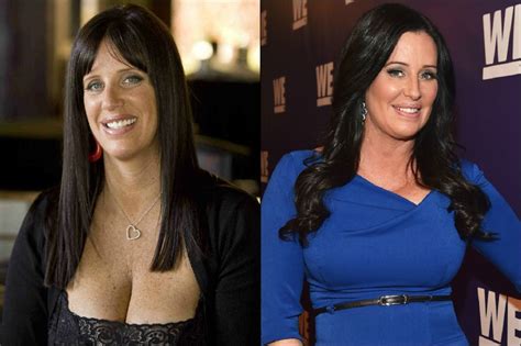 Soleil Moon Frye Before Surgery Images