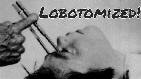 Lobotomized The History Of The Lobotomy Youtube