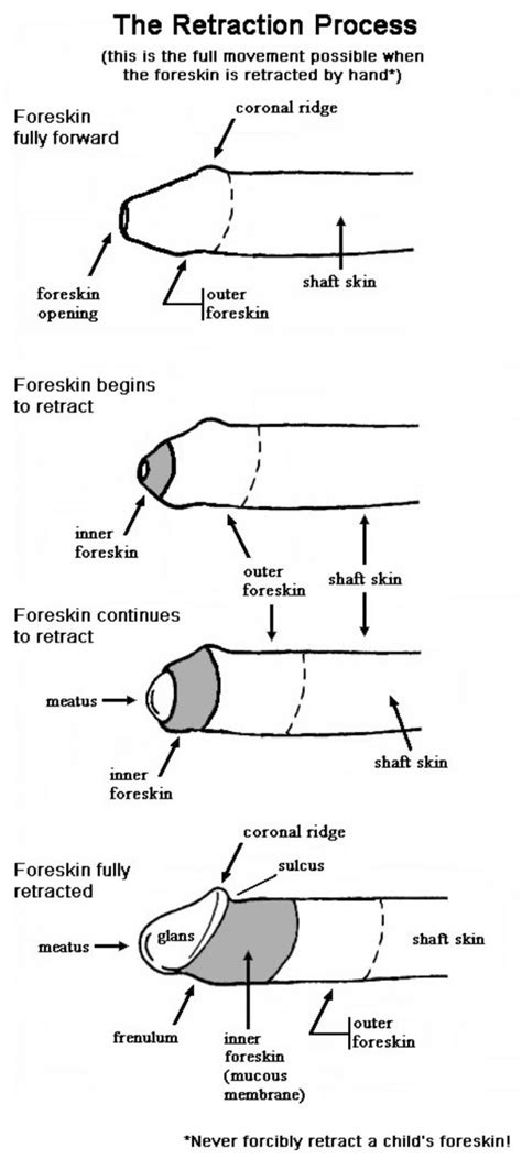 How To Retract Foreskin Natural And Painless Wiki Only Men