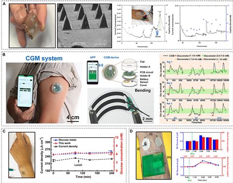 Wearable Electrochemical Sensors For Real Time Monitoring In Diabetes