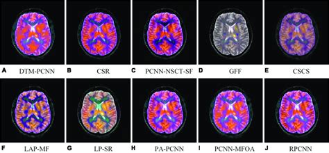 An Example Of Fused Images Generated By Ten Different Mmif Algorithms Download Scientific