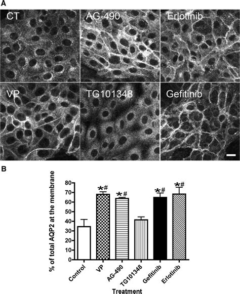 Egf Receptor Inhibition By Erlotinib Increases Aquaporin 2m