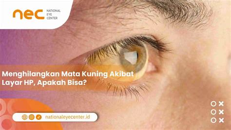 7 Penyebab Mata Panda Gejala Dan Cara Menghilangkannya