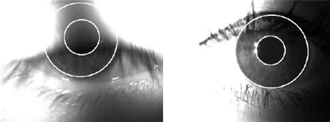 Examples Of Iris Localization Using The Proposed Technique On Some Download Scientific Diagram