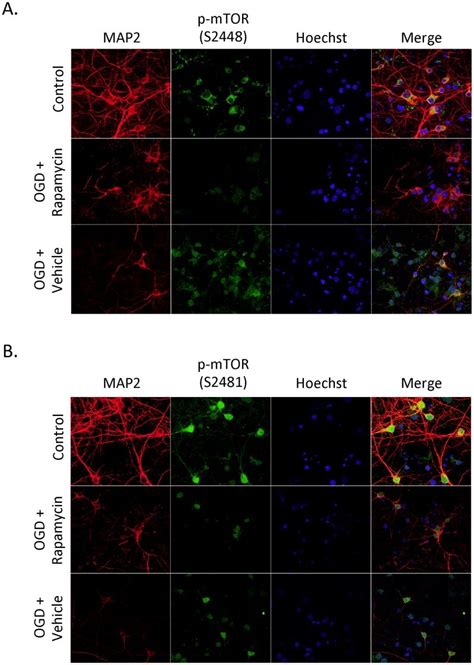 Primary Cortical Neurons Were Subjected To 1 Hour Ogd And Then Treated