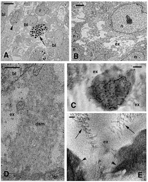 Electron Microscopy View Of Blastema 6 D After Cauterization A