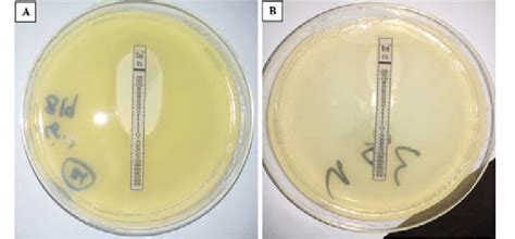 Colistin Susceptibility By E Test A Sensitive Isolate Mic 1 5µ Download Scientific Diagram