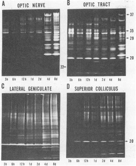 Figure 2 From The Polypeptide Composition Of Intra Axonally Transported Proteins Evidence For
