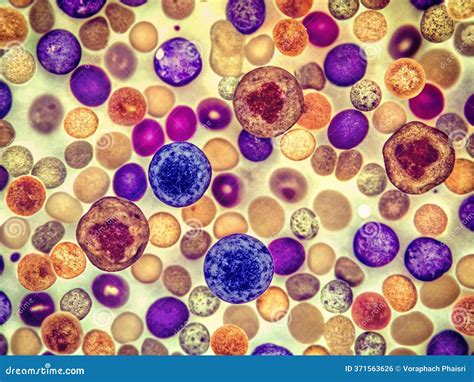 Diffuse Large B Cell Lymphoma Dlbcl Closeup View 3d Illustration Royalty Free Stock Image