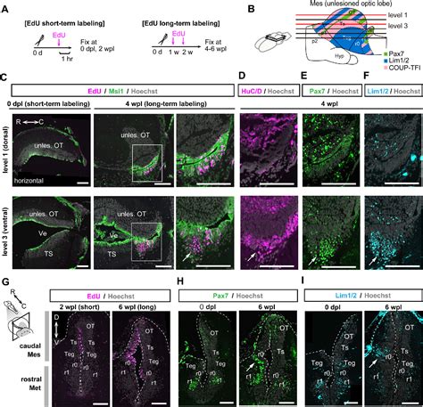 Figure 5 From Spatio Temporal Neural Stem Cell Behavior Leads To Both Perfect And Imperfect