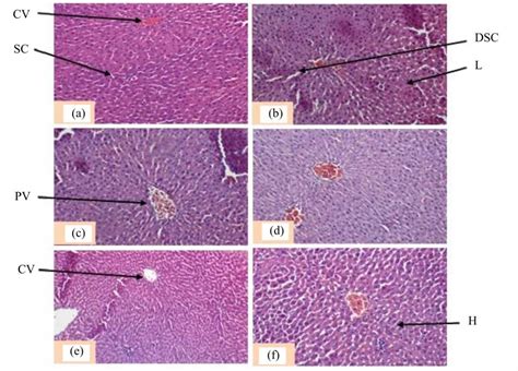 Ganoderma Boninense Ganodermataceae Aqueous Extract Protects Against Liver And Reproductive