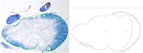 Figure 1 From Effects Of Telemetry Emg Implants On Hindlimb Locomotor Recovery In Thoracic